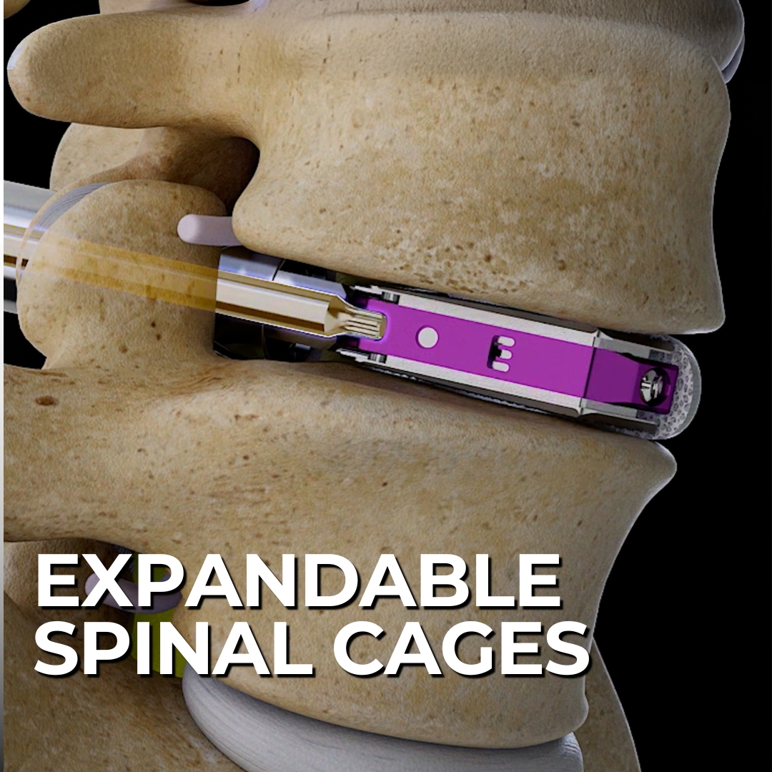 Blog: Complete Guide to Clavicle Fracture Treatment